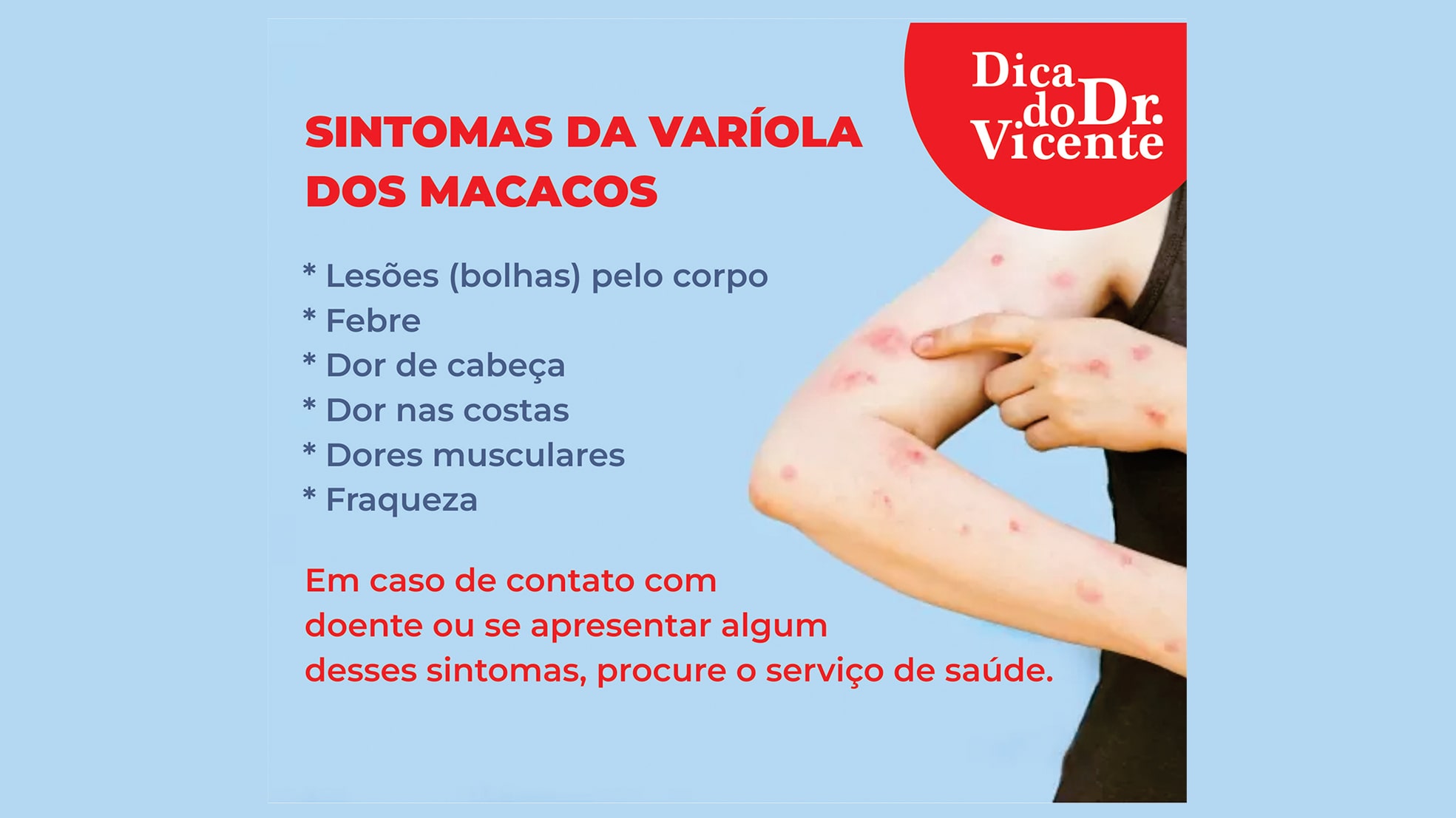 Coluna: varíola dos macacos